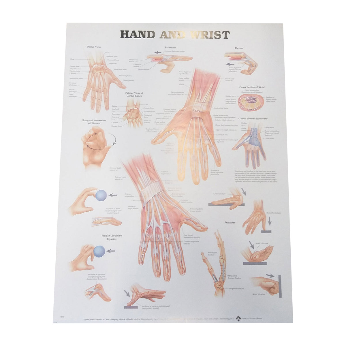Hand and Wrist – AcupunctureShop
